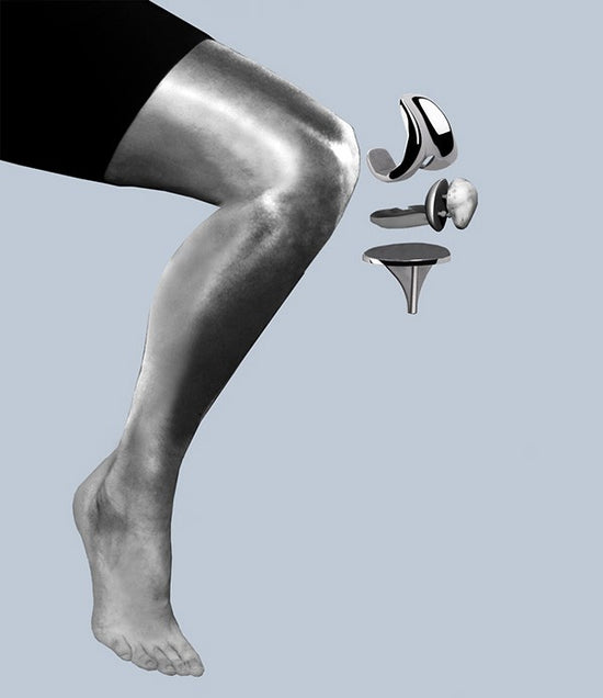 Total Knee Recovery Method: Total Knee Replacement Rehab at Home – PT ...